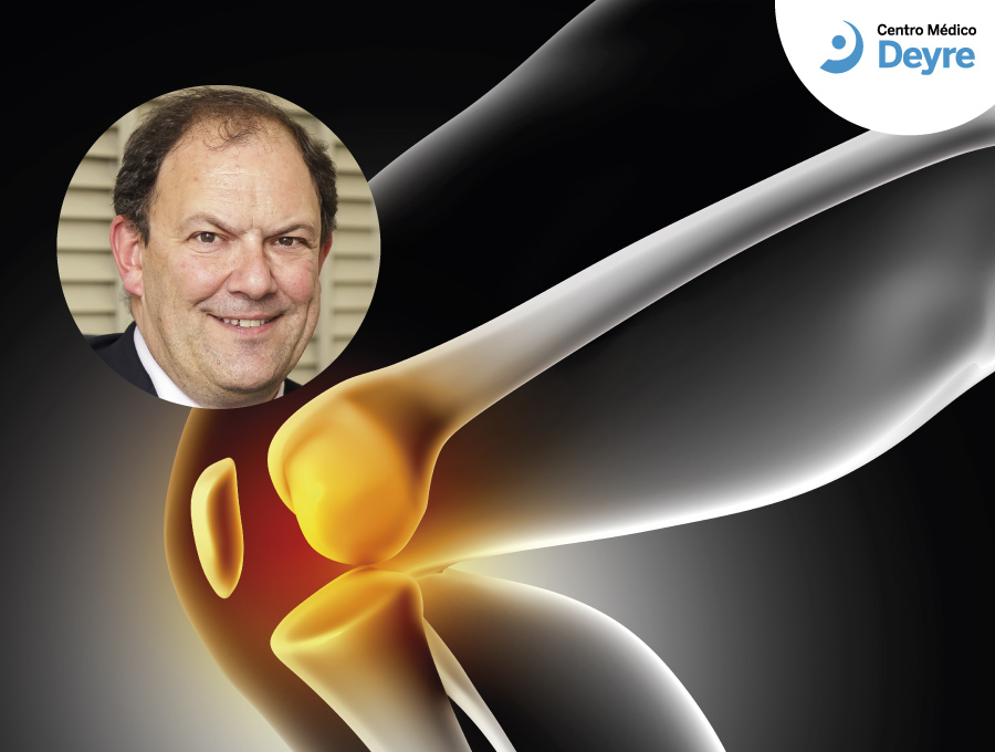 ¿Qué Es La Condropatía? – Condropatía Rotuliana Rodilla – OPHL